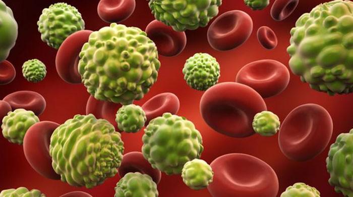 To save lives, WHO wants global focus on catching cancer early