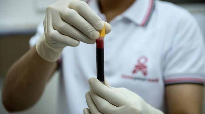 Economic status tied to blood vessel health in kids