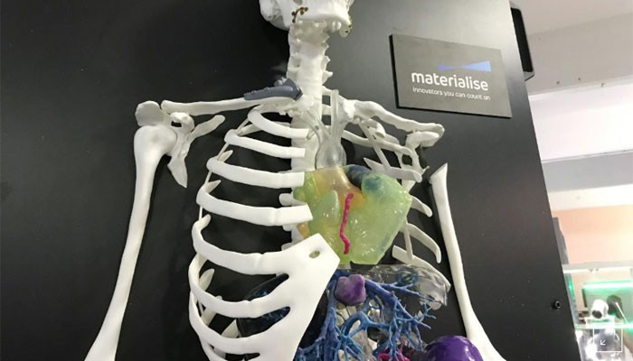 Printing body parts in hospital shows 3D tech's growing reach