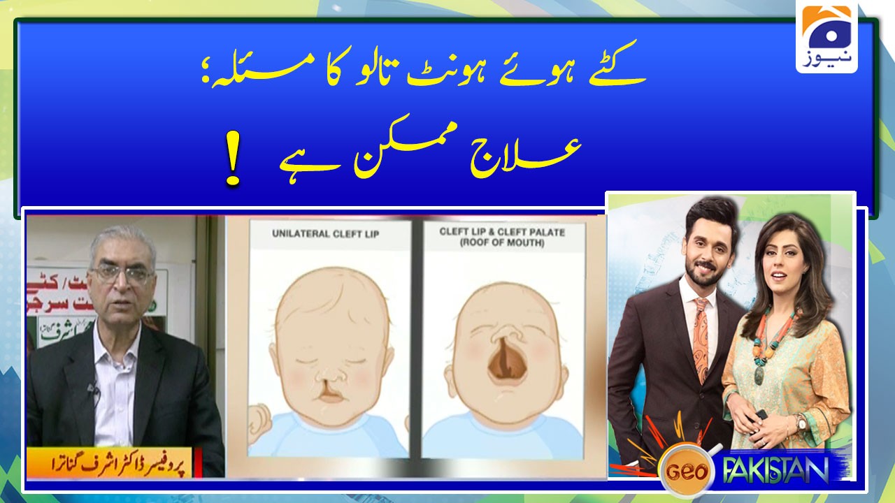 Kate huey hont or talu ka masla: ilaaj mumkin hai! | TV Shows - geo.tv