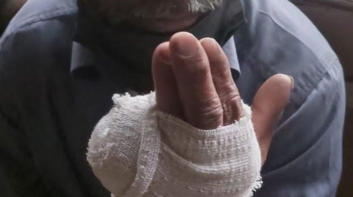 Love marriage dispute: Girl's father bites off finger of boy's dad ...