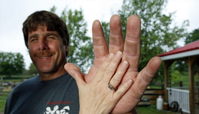 US man with 'gigantic hands' astonishes netizens
