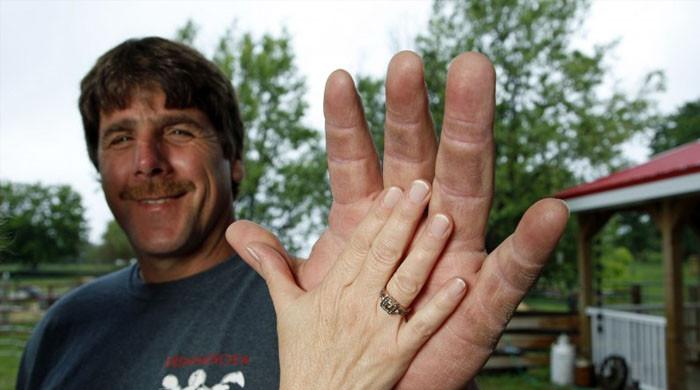 US man with 'gigantic hands' astonishes netizens