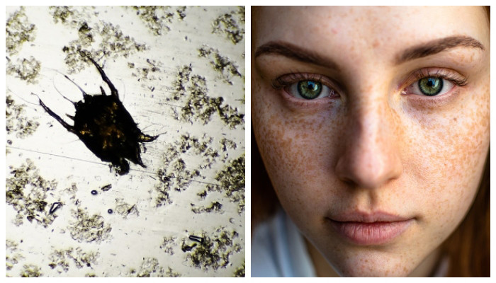 Did you know thousands of mites live on your face?