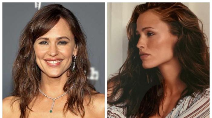 Jennifer Garner opens up about injectables and cosmetic surgery