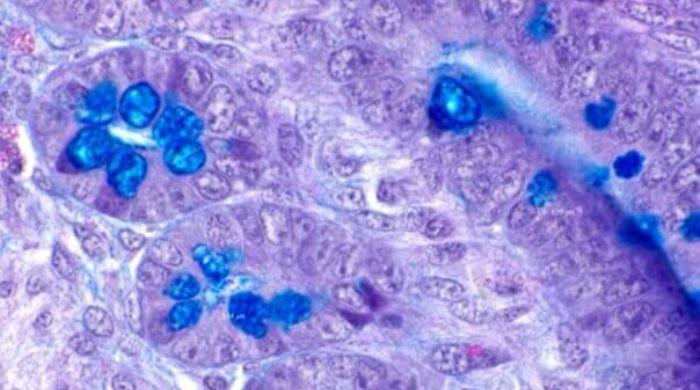 Tiny particles in food colouring may be harmful to your gut