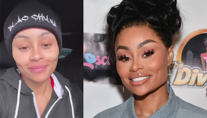 Blac Chyna urges young women to avoid going for cosmetic surgery