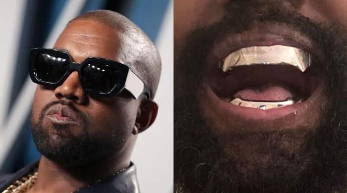 Kanye West's ‘detrimental' titanium teeth render rapper unable to chew