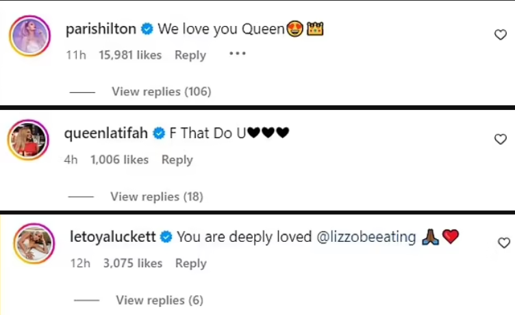 Lizzo showered with support from Paris Hilton, Queen Latifa, more after ...