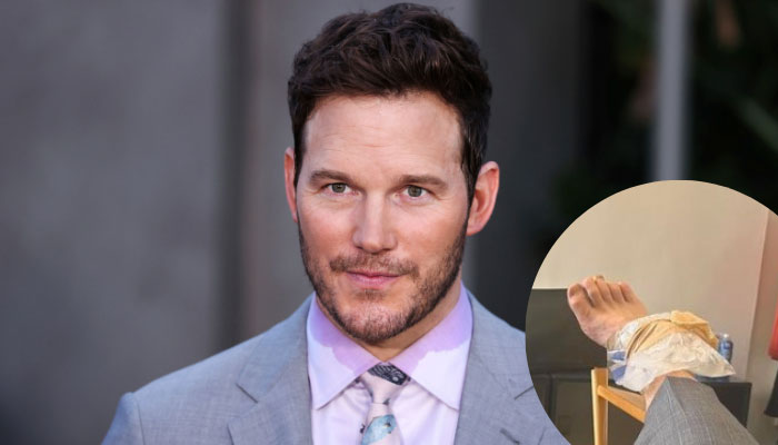 Chris Pratt off to rough start, sustains injury while filming ‘Mercy'