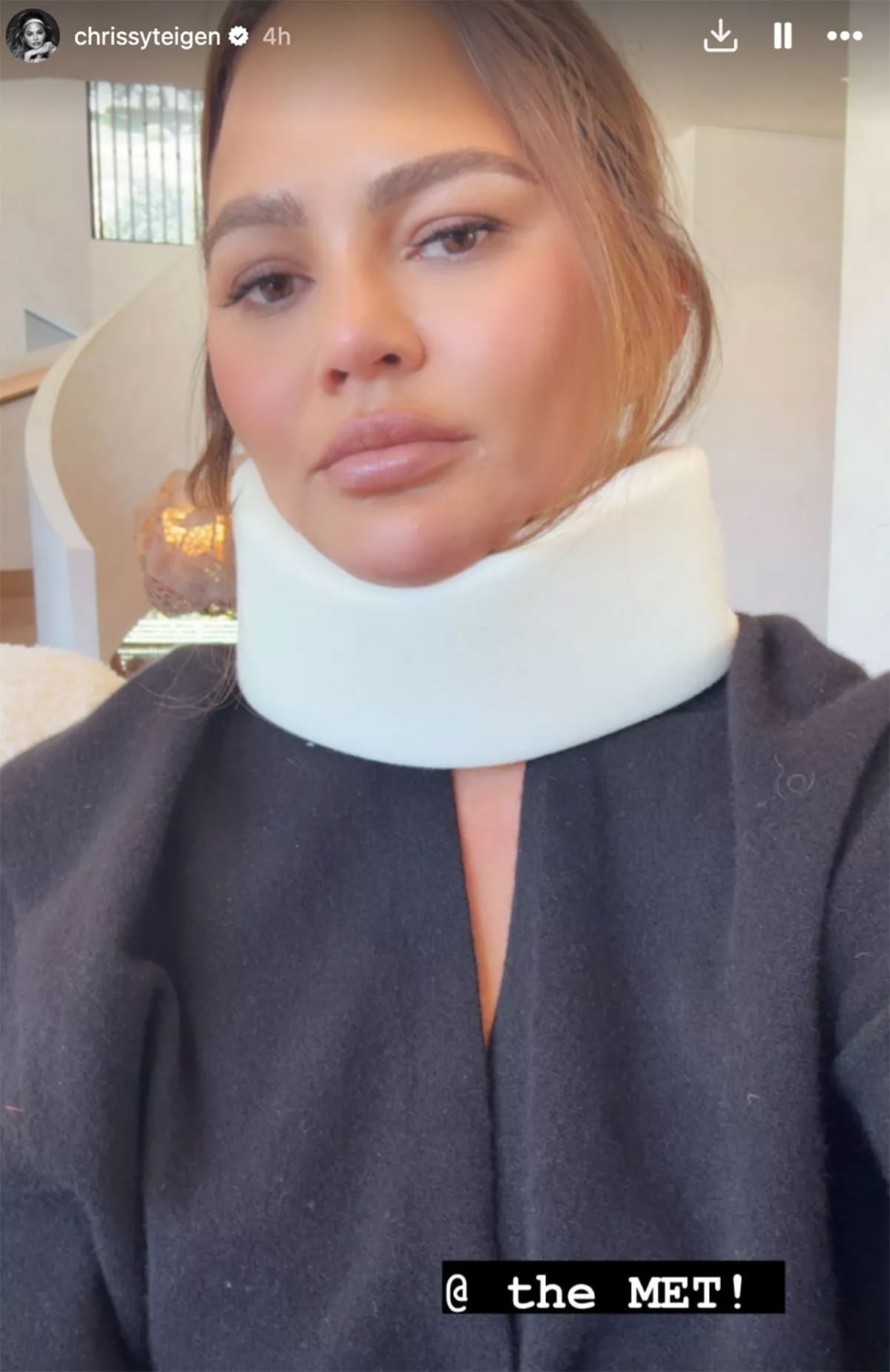 Chrissy Teigen daring causes injury, John Legend says