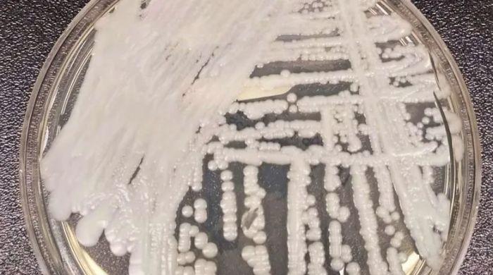 ‘Superbug' fungus infections approach record high in US